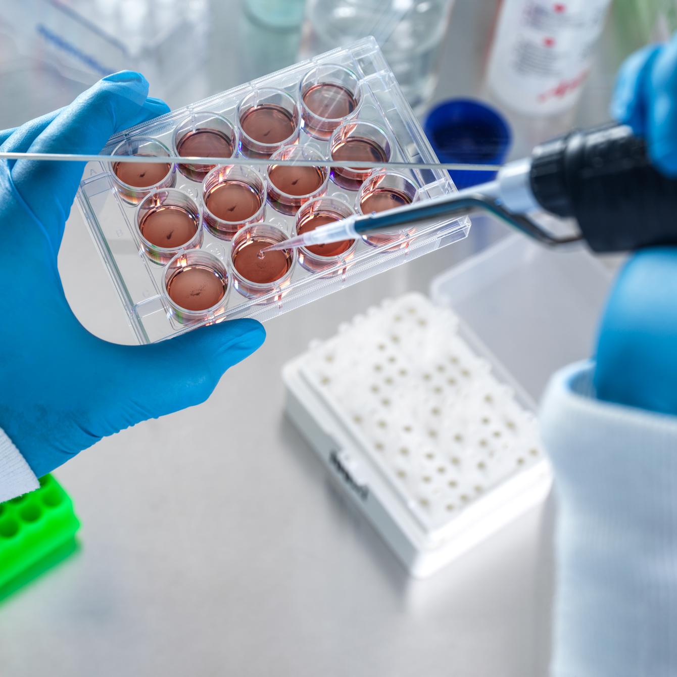 Department of Urology | NYU Grossman Long Island School of Medicine ...